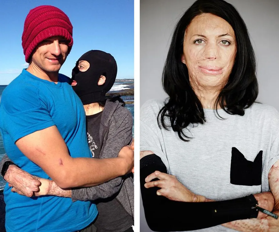 Turia Pitt is Australia's most inspiring woman