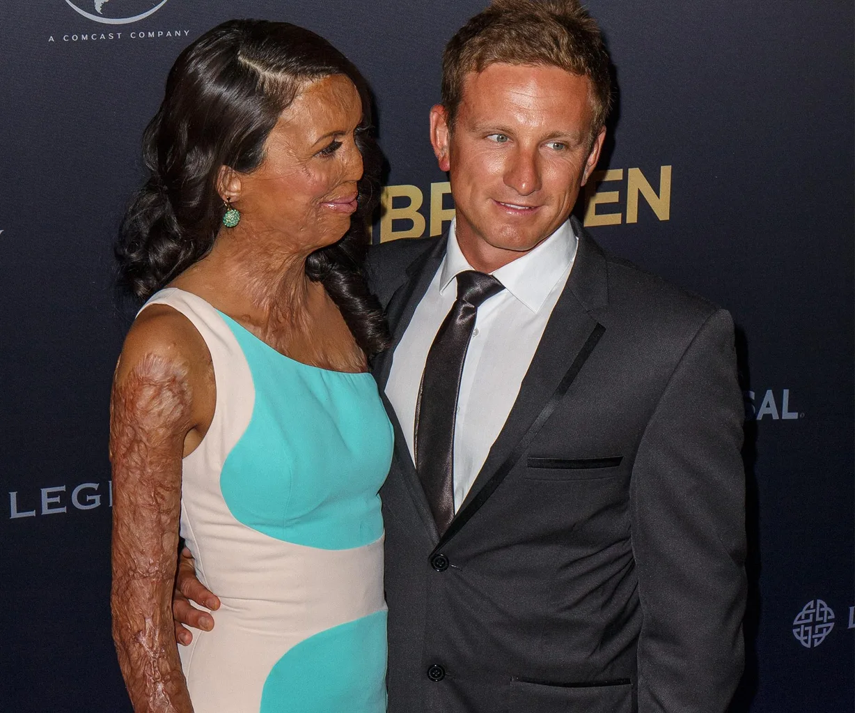 Turia Pitt and Michael Hoskin love story in pictures