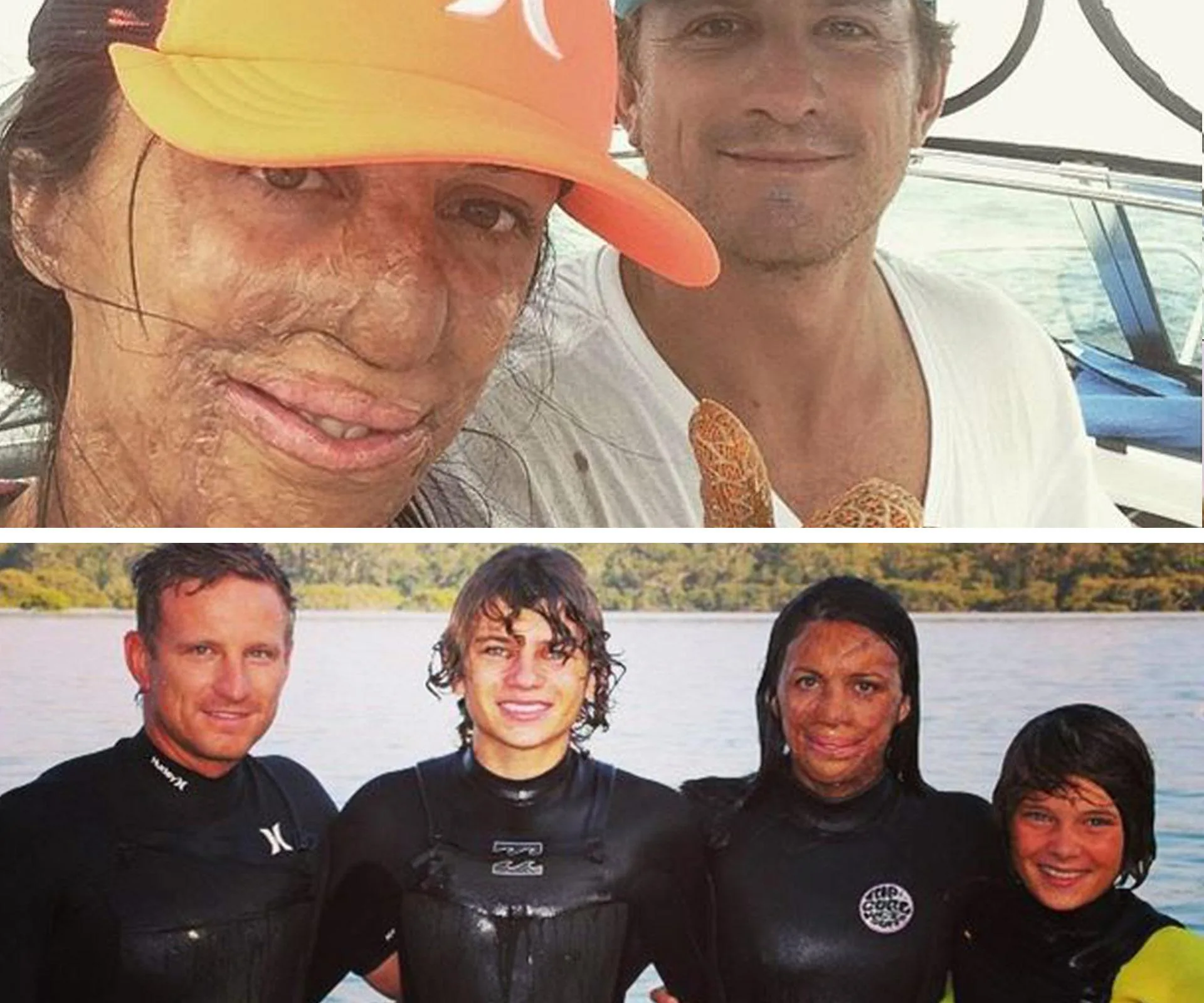 Turia Pitt and Michael Hoskin love story in pictures