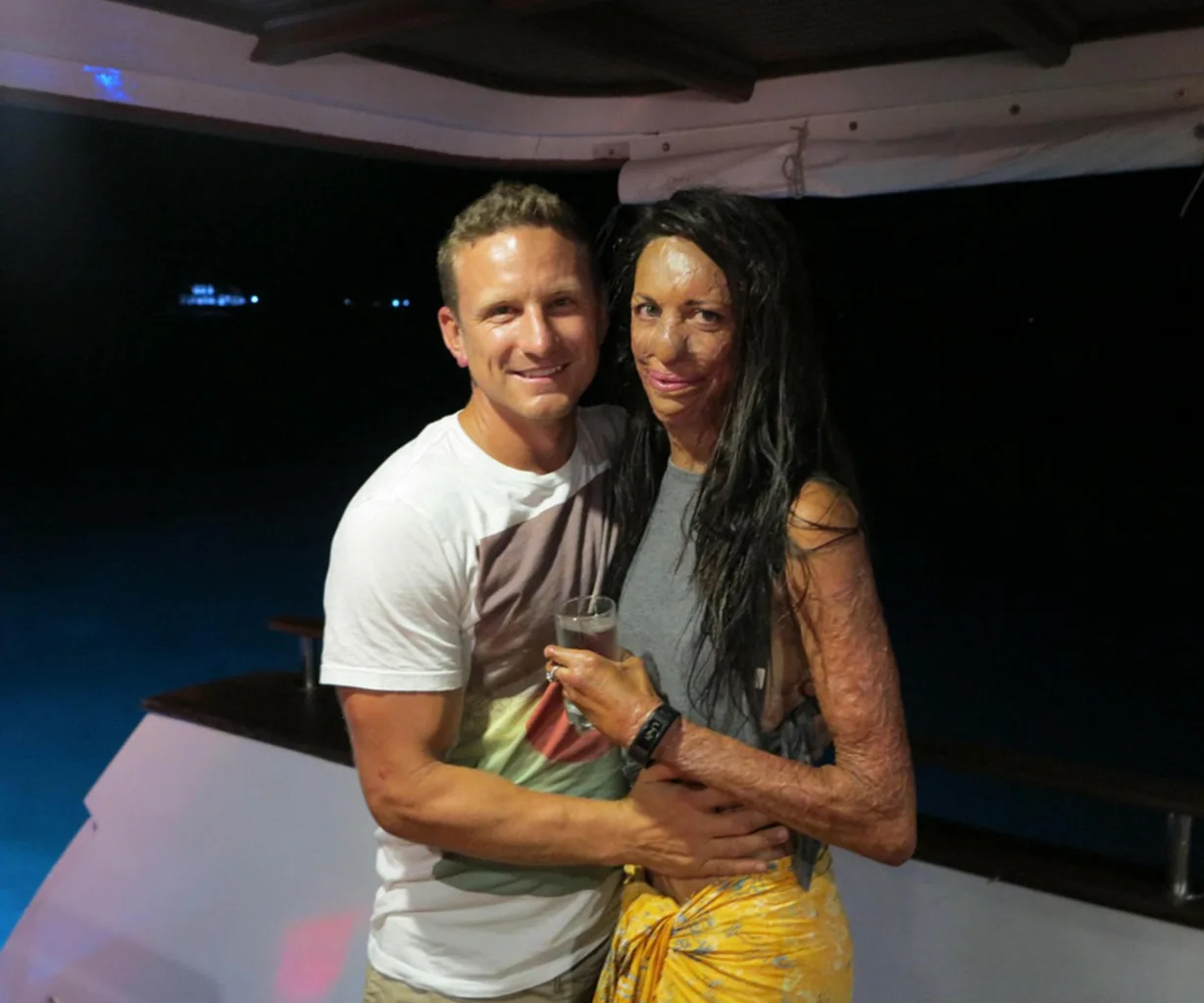 Turia Pitt and Michael Hoskin love story in pictures