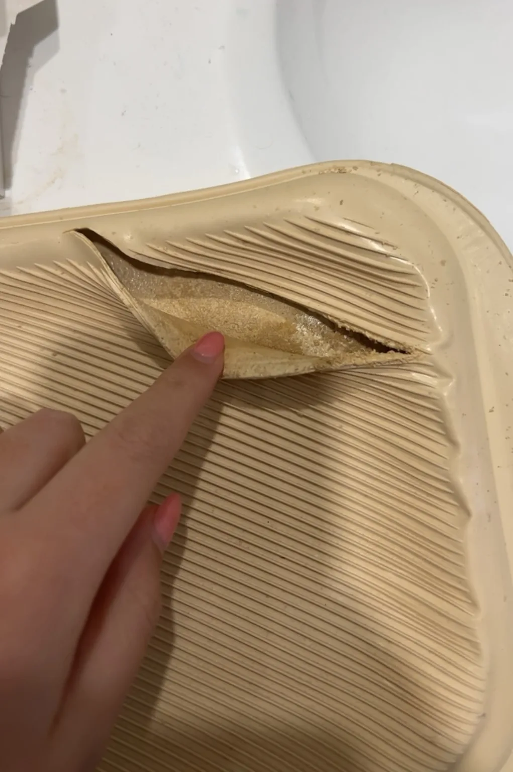 Warning: Hot water bottle burns left me scarred for life | Now To Love ...