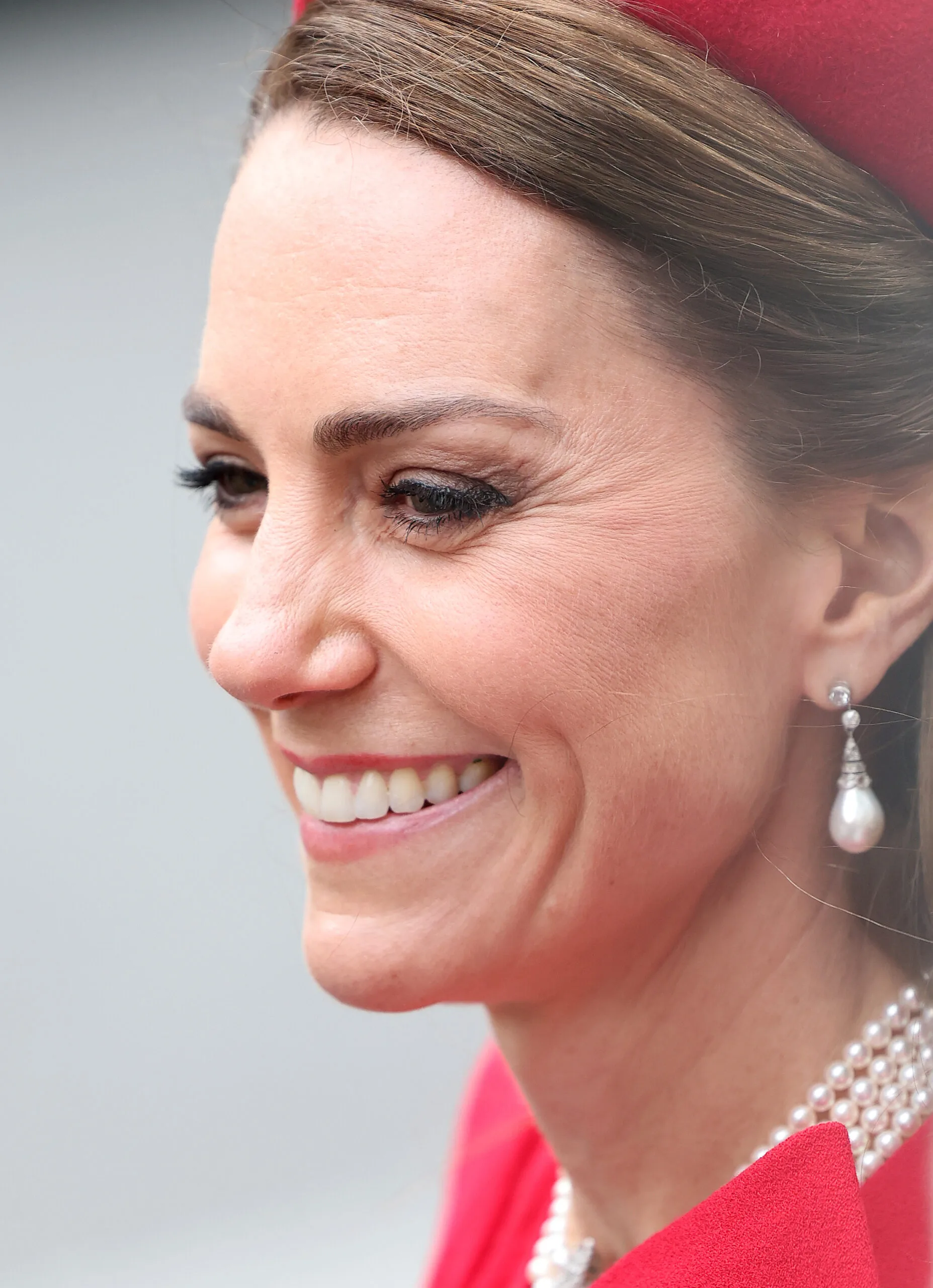 Star-studded smiles: The best celebrity grins | Now To Love