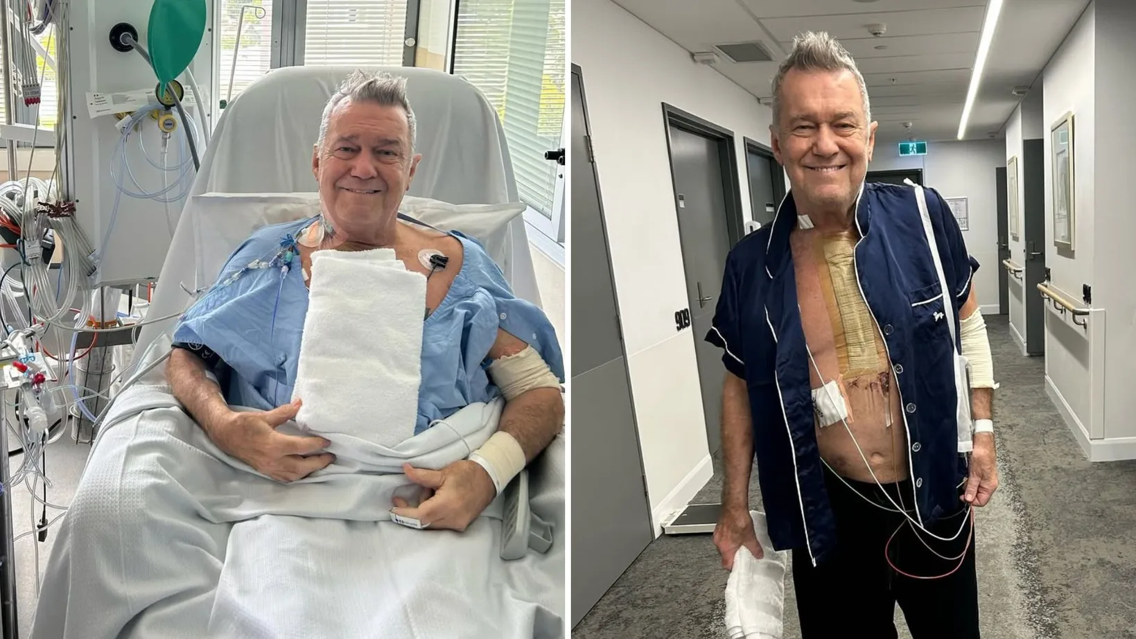 Inside Jimmy Barnes' endless health journey