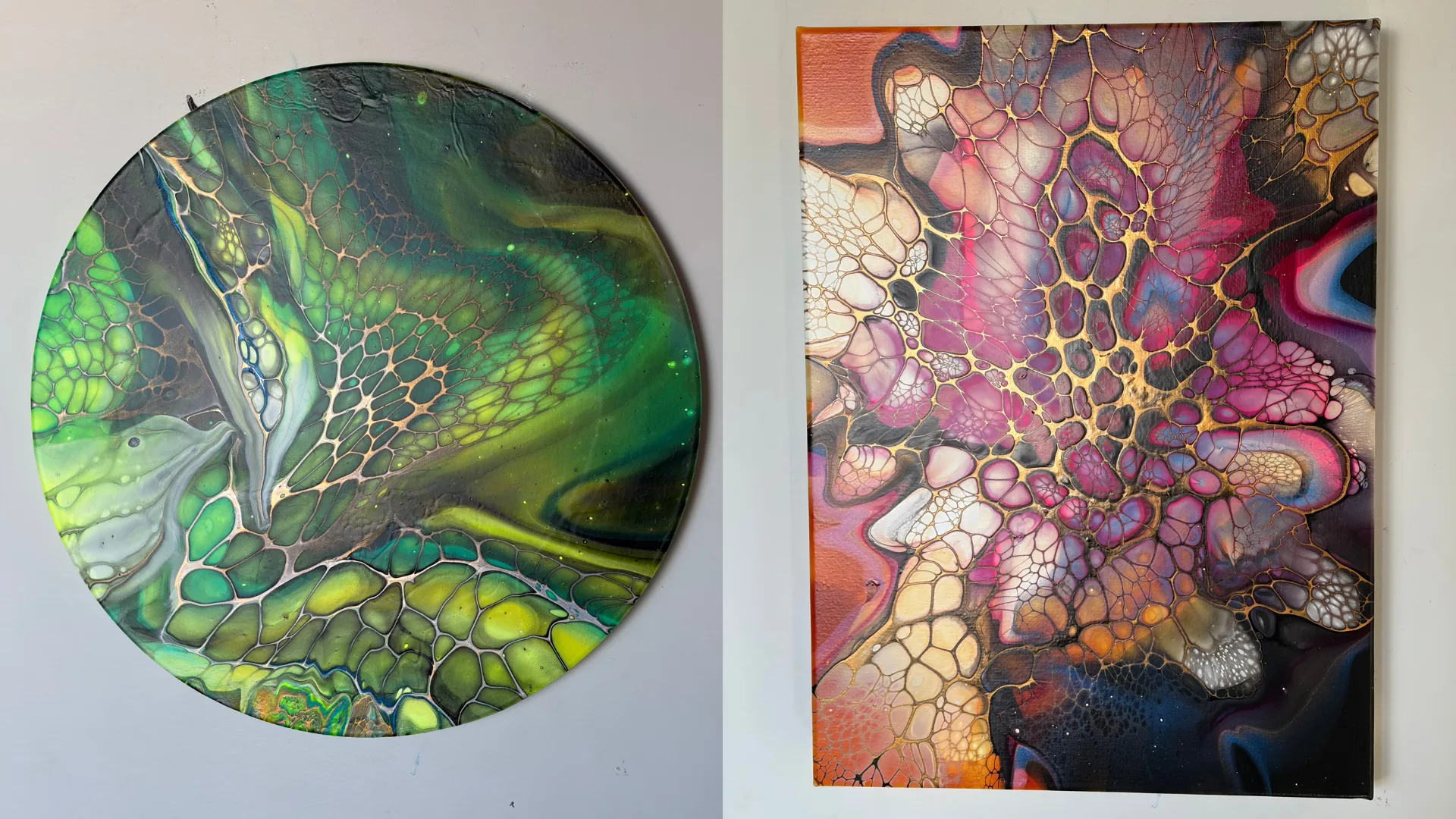 I lost half my skull, but I kept on painting | Now To Love