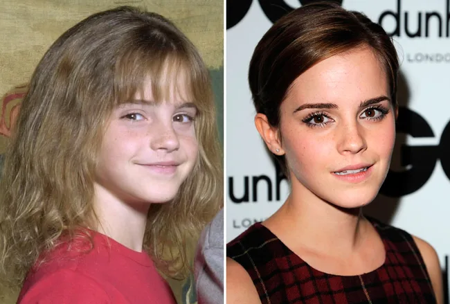 emma watson kiddle