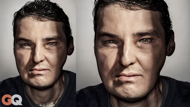 Face transplant recipient lands GQs ground breaking cover