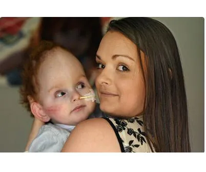 Baby boy born with no brain says “mum”