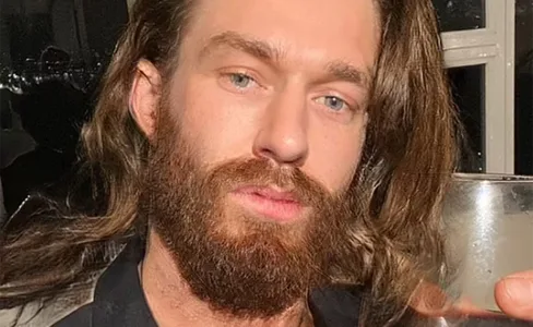 Big Brother winner Chad Hurst's dramatic transformation