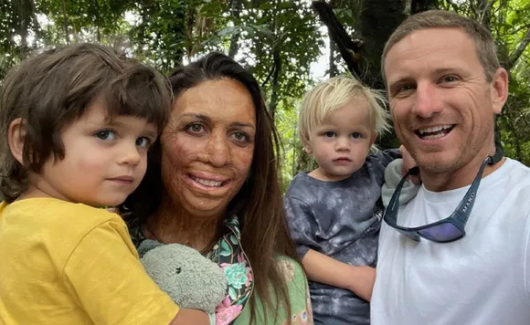 Turia Pitt breaks down beauty standards with groundbreaking campaign
