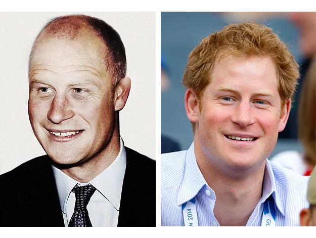 Baldness for Prince Harry and William by age 50?