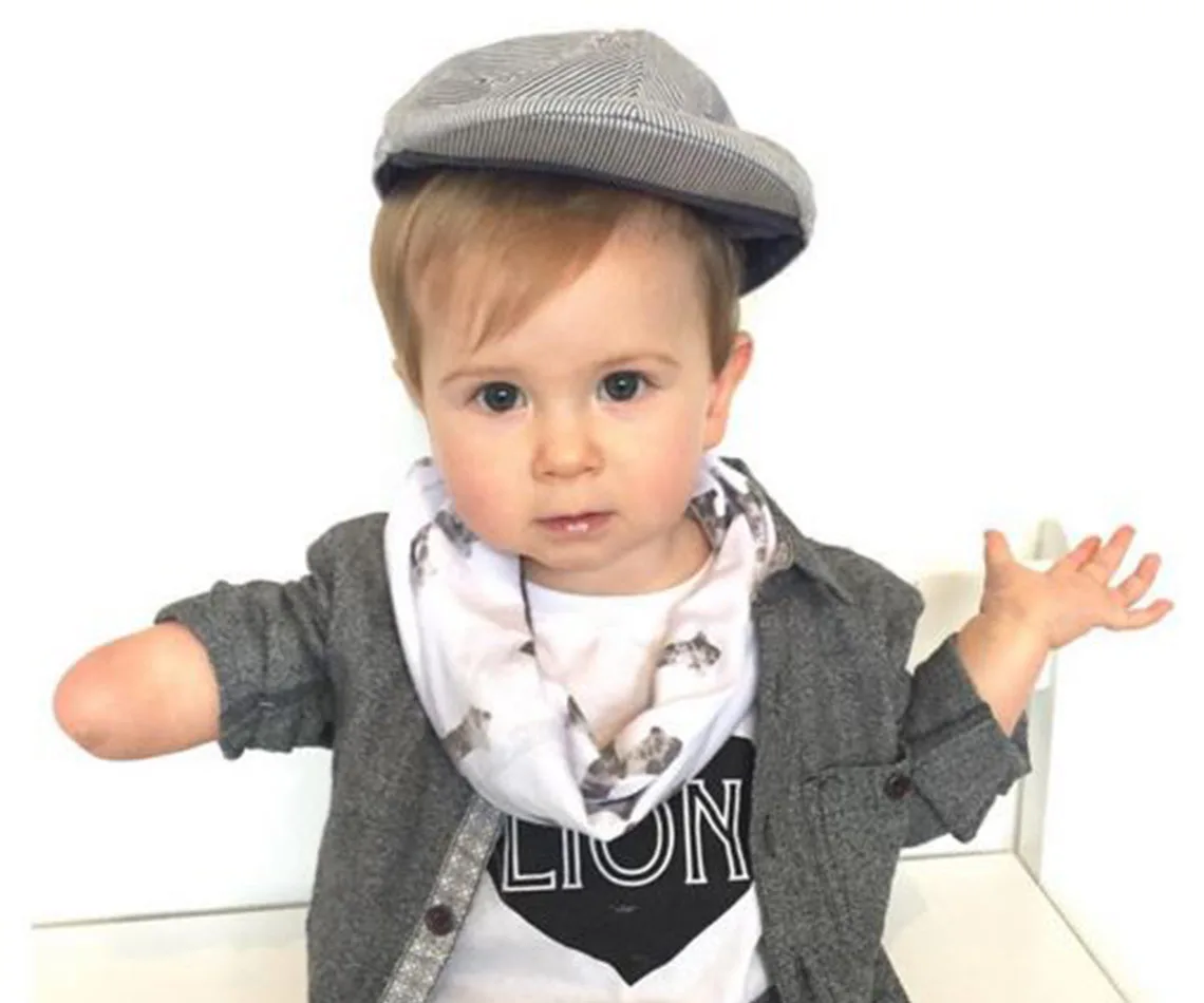 Meet the one-armed toddler shaking up Instagram