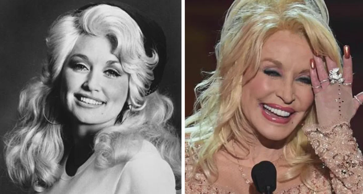 dolly parton before implants