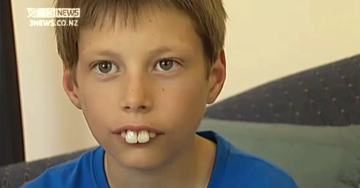 Buck-toothed boy gets a smile makeover