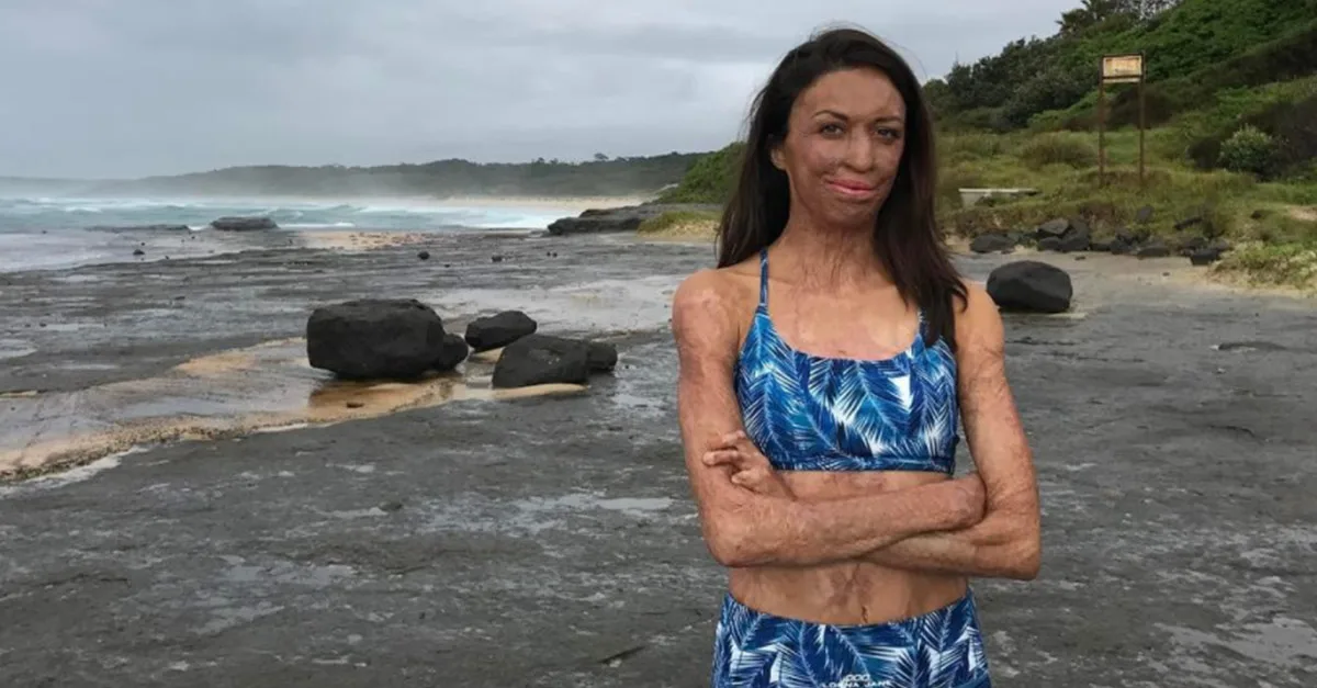 Turia Pitt inspirational moments