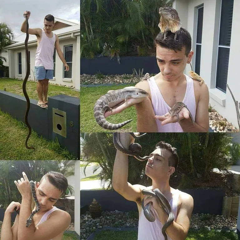 Young snake handler fighting for his life after bite