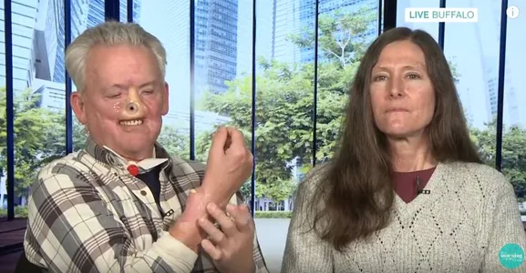 Grizzly bear ripped off this man's face