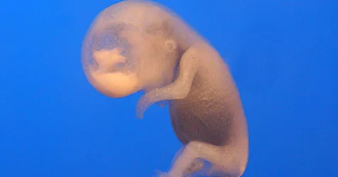 Embryo frozen 24 years ago has finally been born