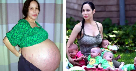 pregnant octuplets
