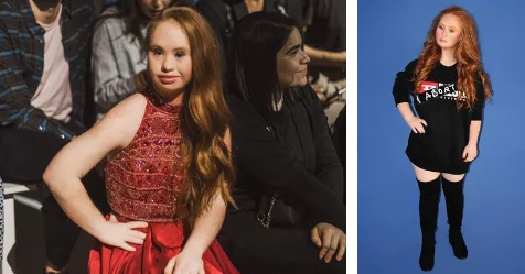 The inspirational story of model Madeline Stuart