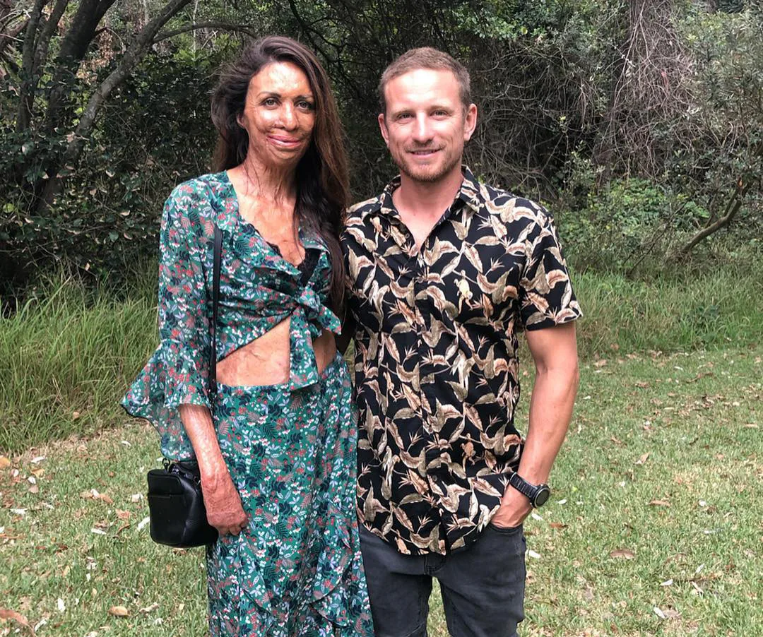 Turia Pitt before the fire that burned 65 per cent of her body