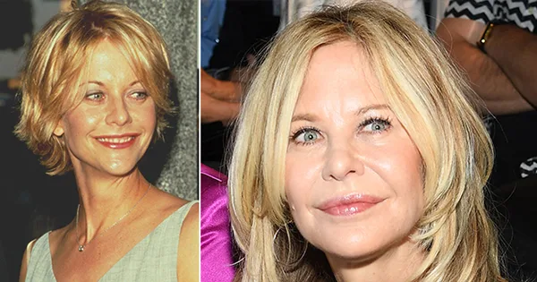 meg ryan operation