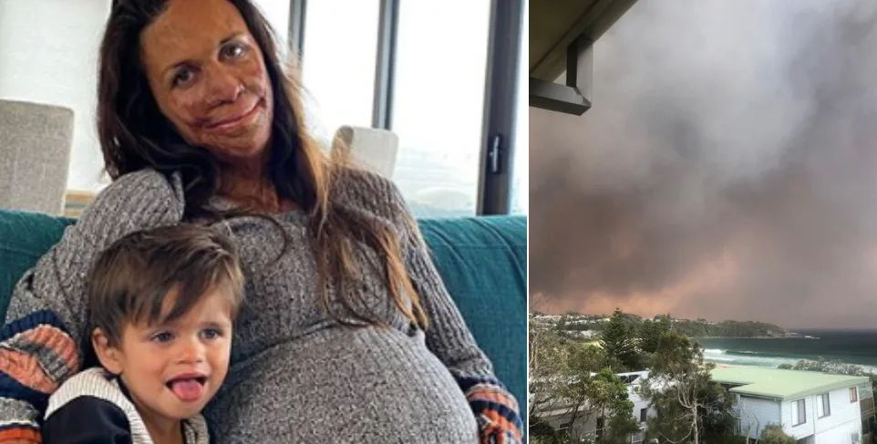 Turia Pitt sparks new movement in midst of bushfire crisis