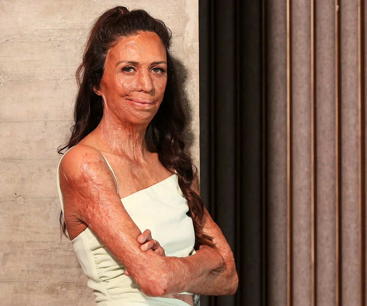Turia Pitt on being a role model to her two young sons