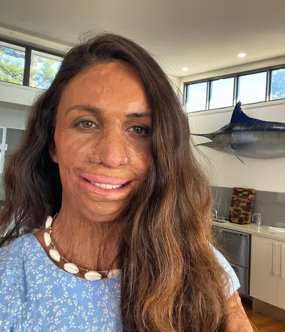 Turia Pitt's Spend With Them campaign's epic 12-month evolution