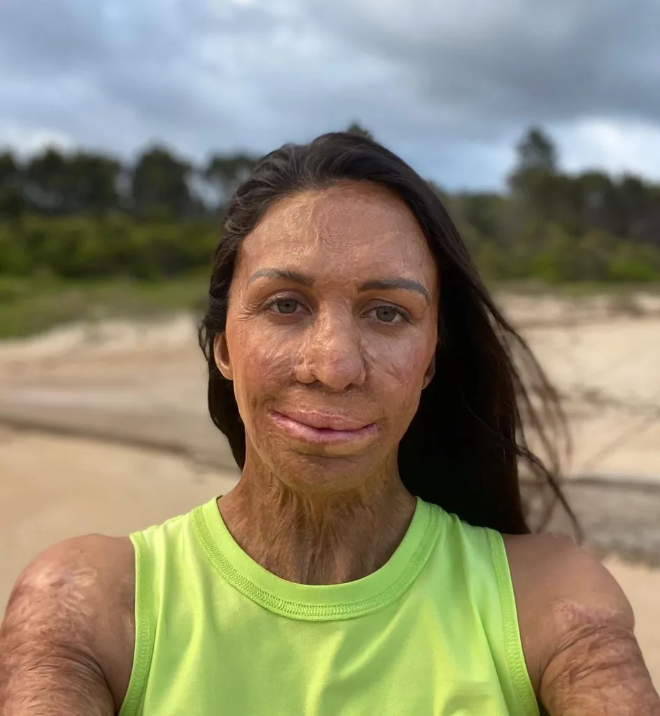 Turia Pitt breaks down beauty standards with groundbreaking campaign