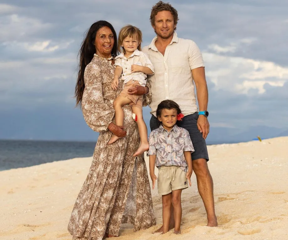 Turia Pitt on the "confronting" images taken days after fire
