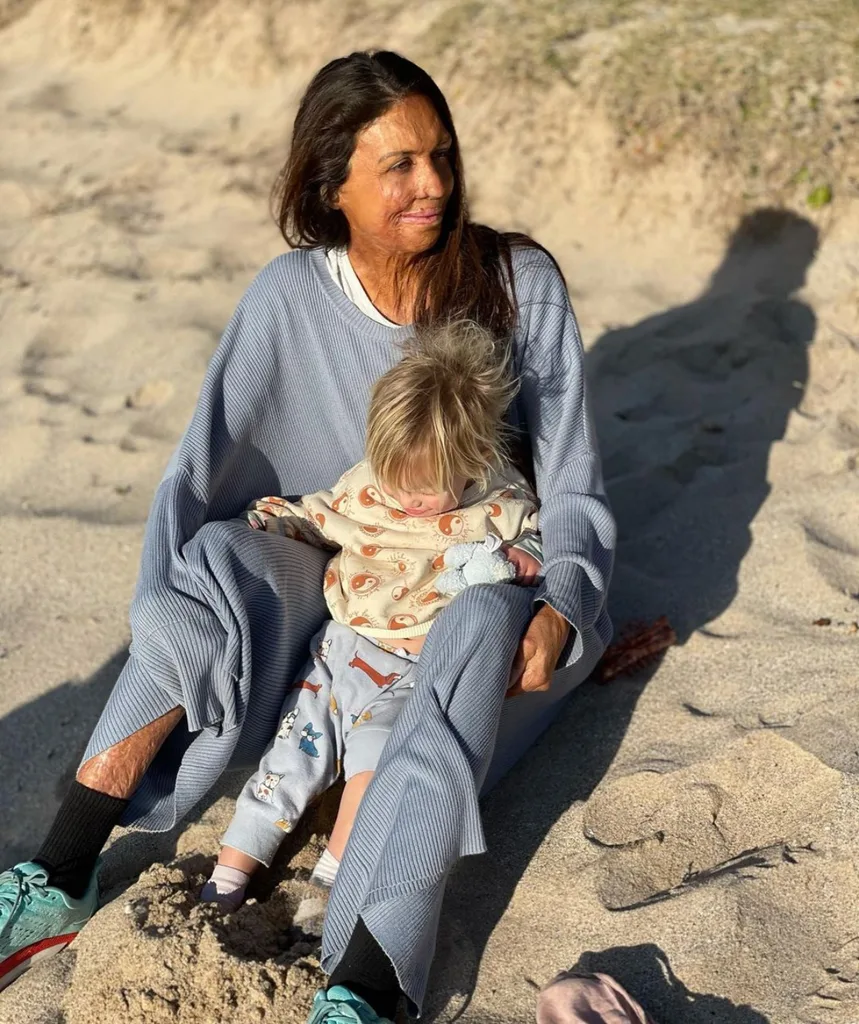 Turia Pitt recovering from nose reconstruction surgery