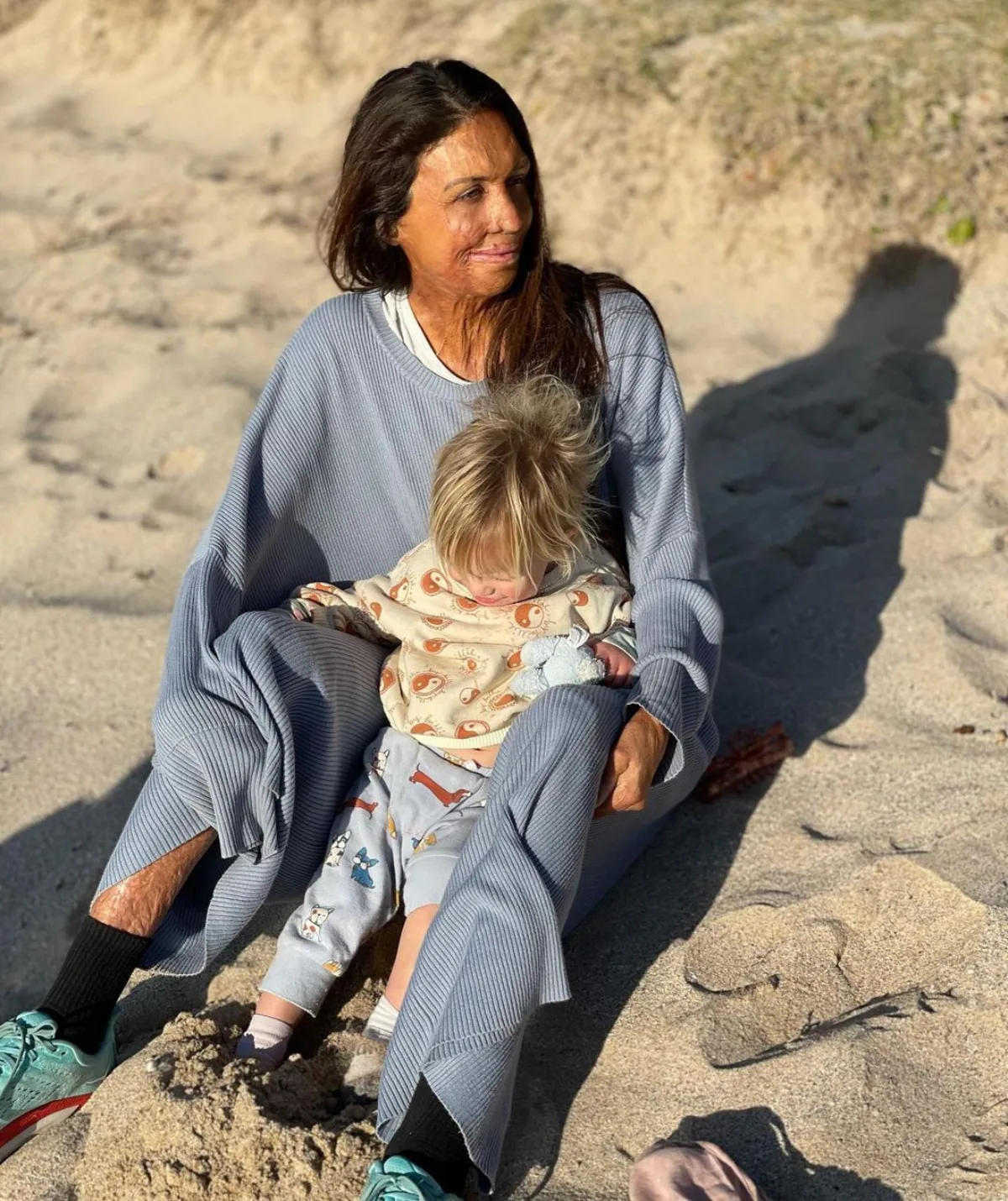 Turia Pitt recovering from nose reconstruction surgery