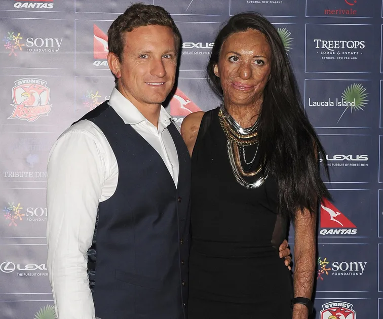Australian bush fire survivor Turia Pitt is pregnant