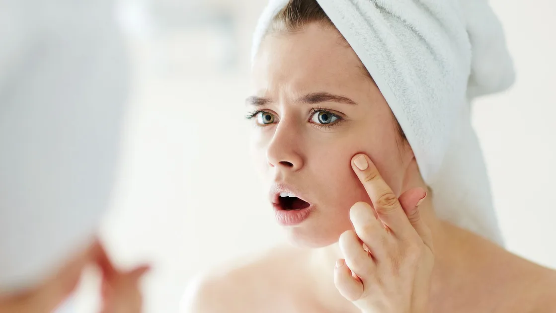 How to tackle a blind pimple